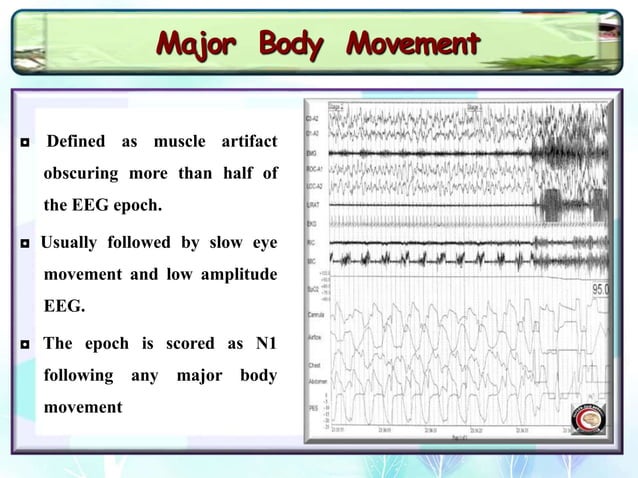 Polysomnogram interpretetion | PPTX