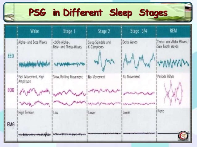 Polysomnogram interpretetion | PPTX