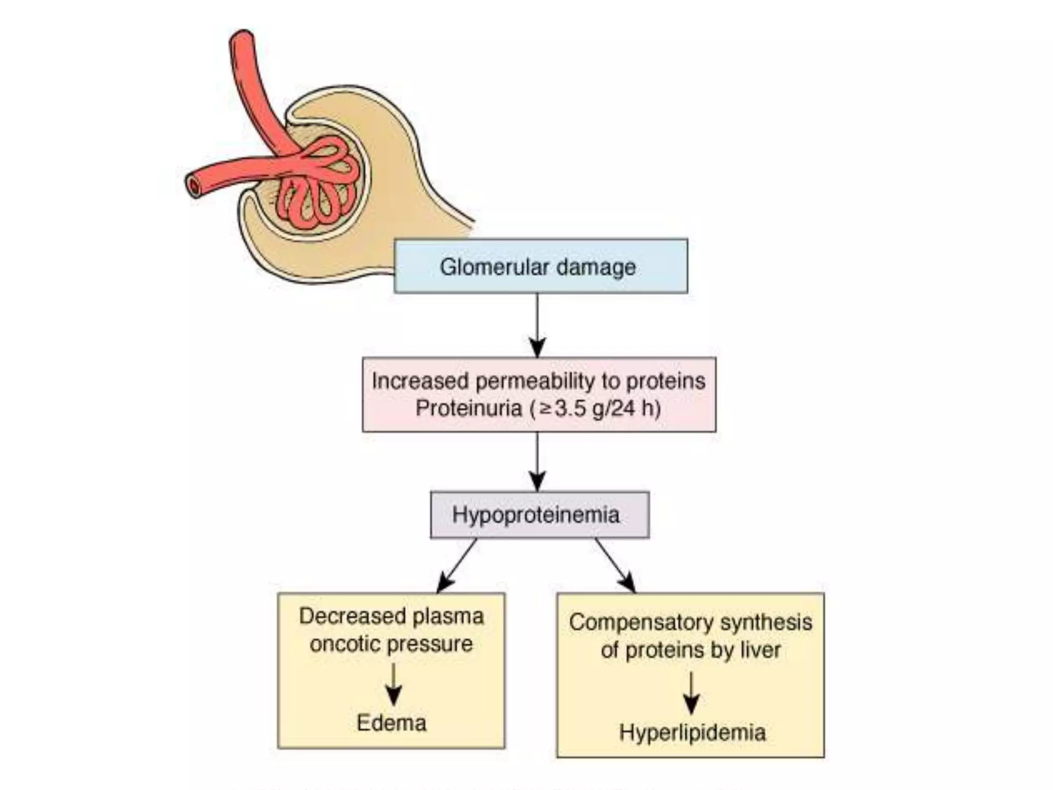 Psgn nephrotic syndrome | PPTX