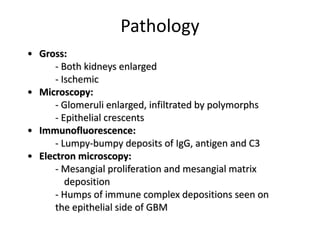 Psgn nephrotic syndrome | PPT
