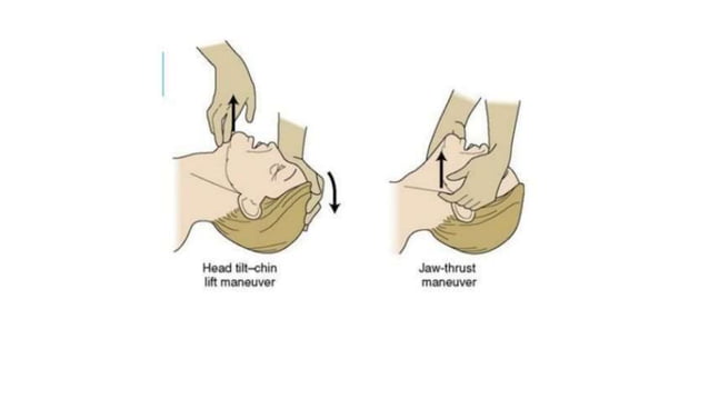 PRIMARY SURVEY AND INITIAL ASSESSMENT OF TRAUMA | PPTX | First Aid ...