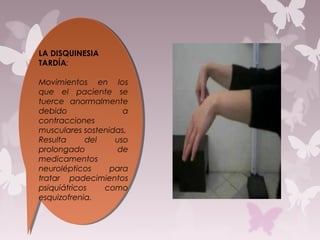 Psicopatología de la Psicomotricidad | PPT