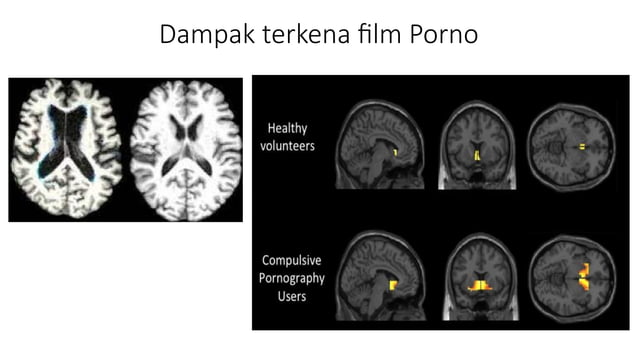Psikologi faal bab 2 sistem syaraf, sel glia dan teknik arah neuroanatomis | PPT
