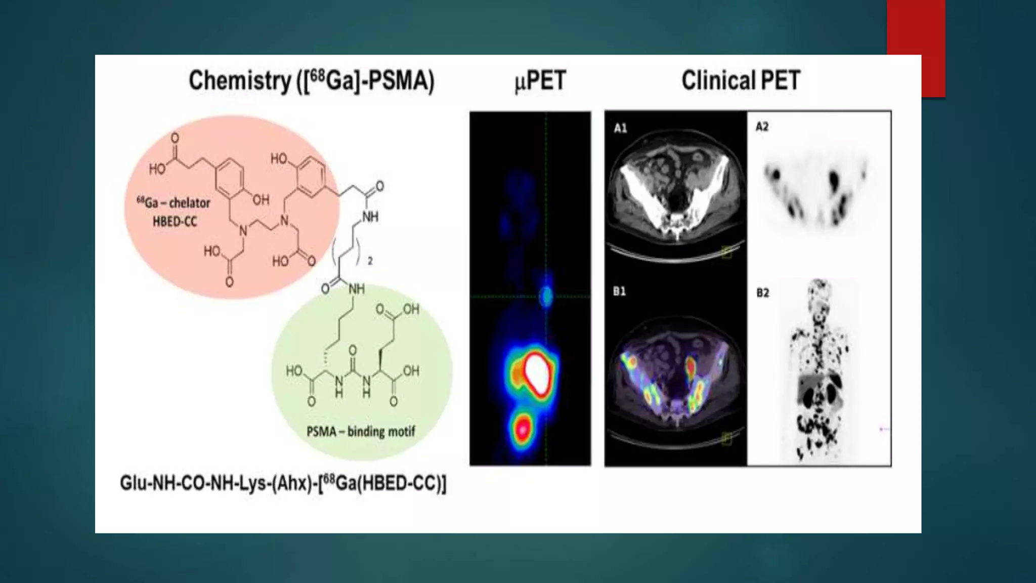 PSMA pet ct scan | PPTX