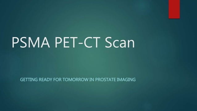 PSMA pet ct scan | PPTX | Cancer | Diseases and Conditions