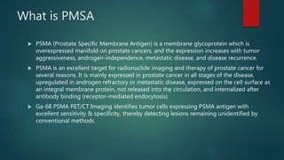 PSMA pet ct scan | PPTX