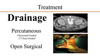 Psoas absces | PPTX