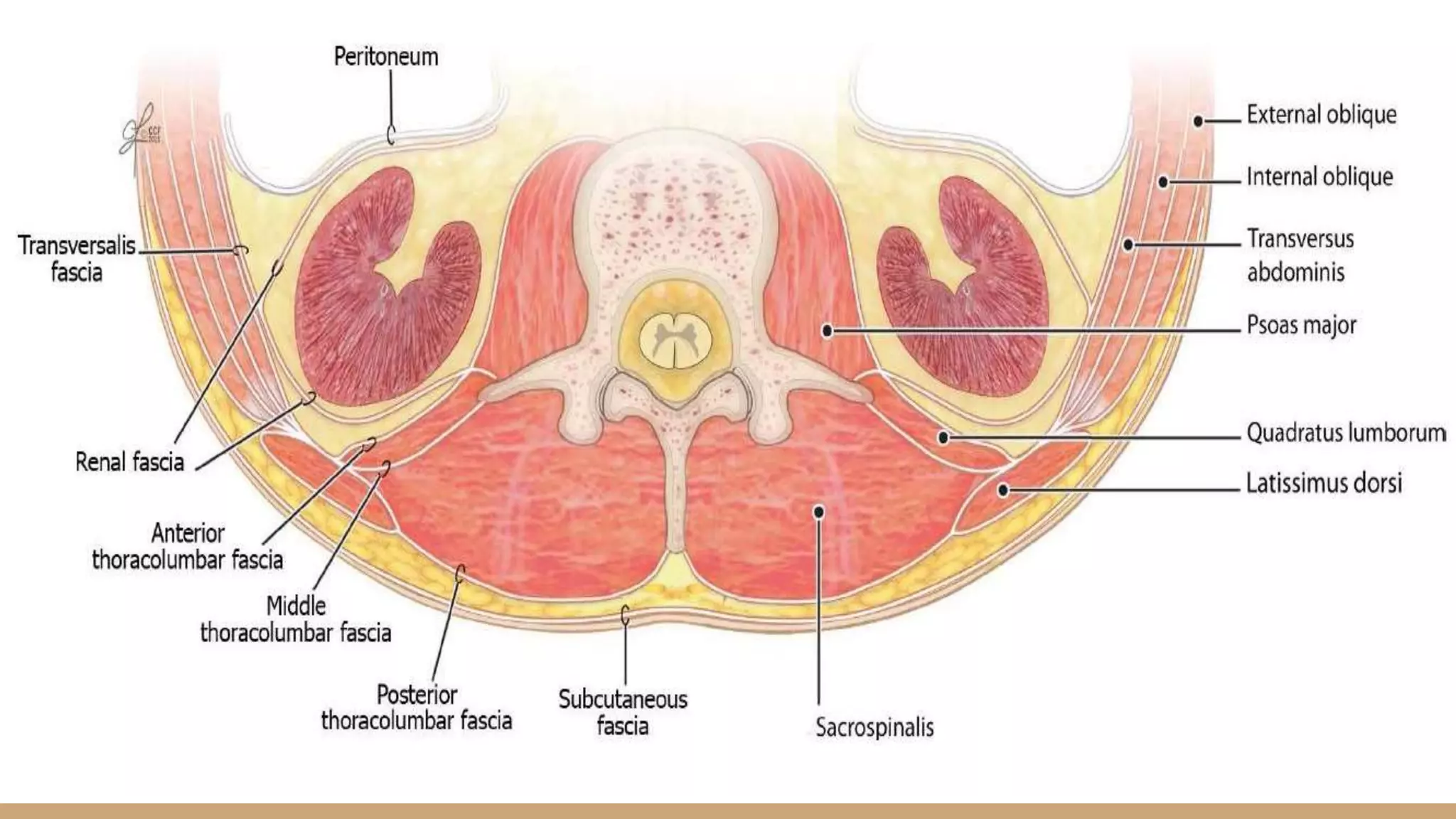 Psoas abscess | PPTX