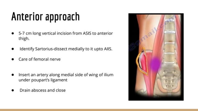 Psoas abscess | PPTX | Digestive Disorders | Diseases and Conditions