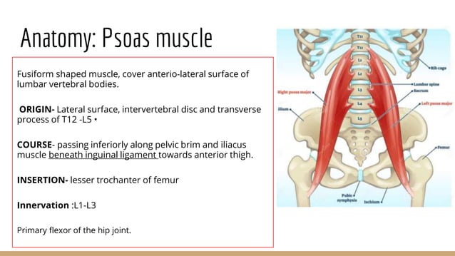 Psoas abscess