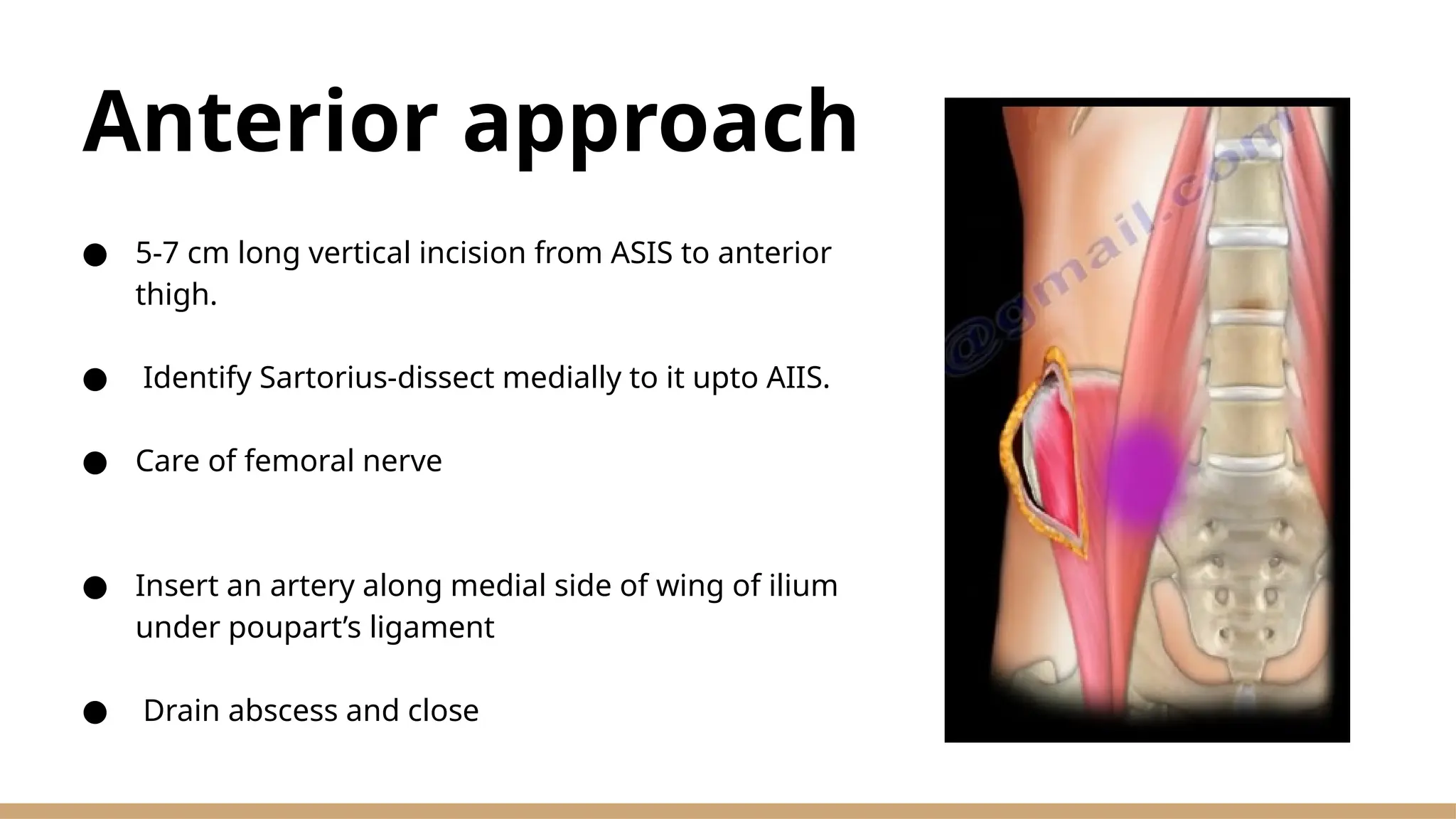 Psoas abses in adult pediatric and management | PPT
