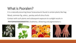 Psoralen.pptx