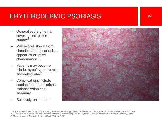 Psoriasi dalla diagnosi agli approcci clinici