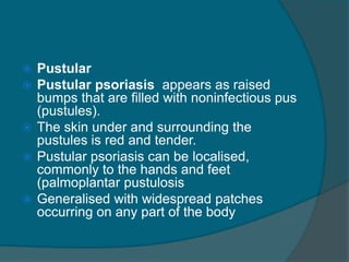 Psoriasis | PPTX