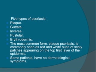 Psoriasis | PPTX