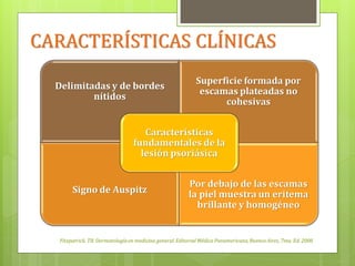 Psoriasis | PDF