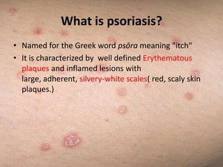 Psoriasis | PPTX