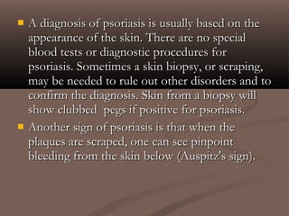 Psoriasis | PPT