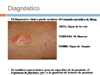 Psoriasis | PPT
