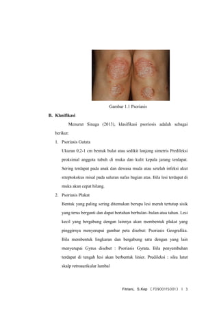 Psoriasis | PDF