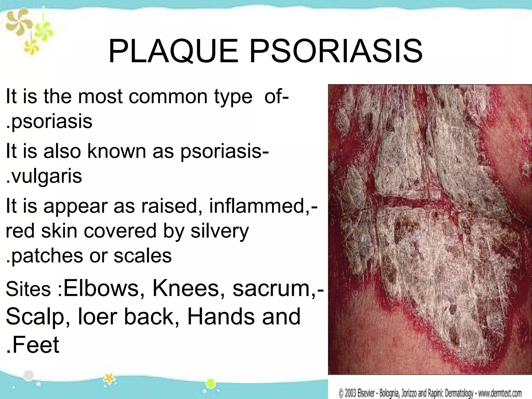 Psoriasis | PPT