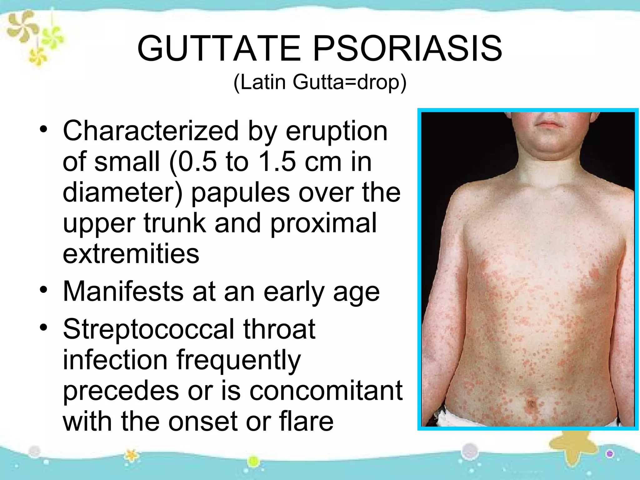 Psoriasis | PPT