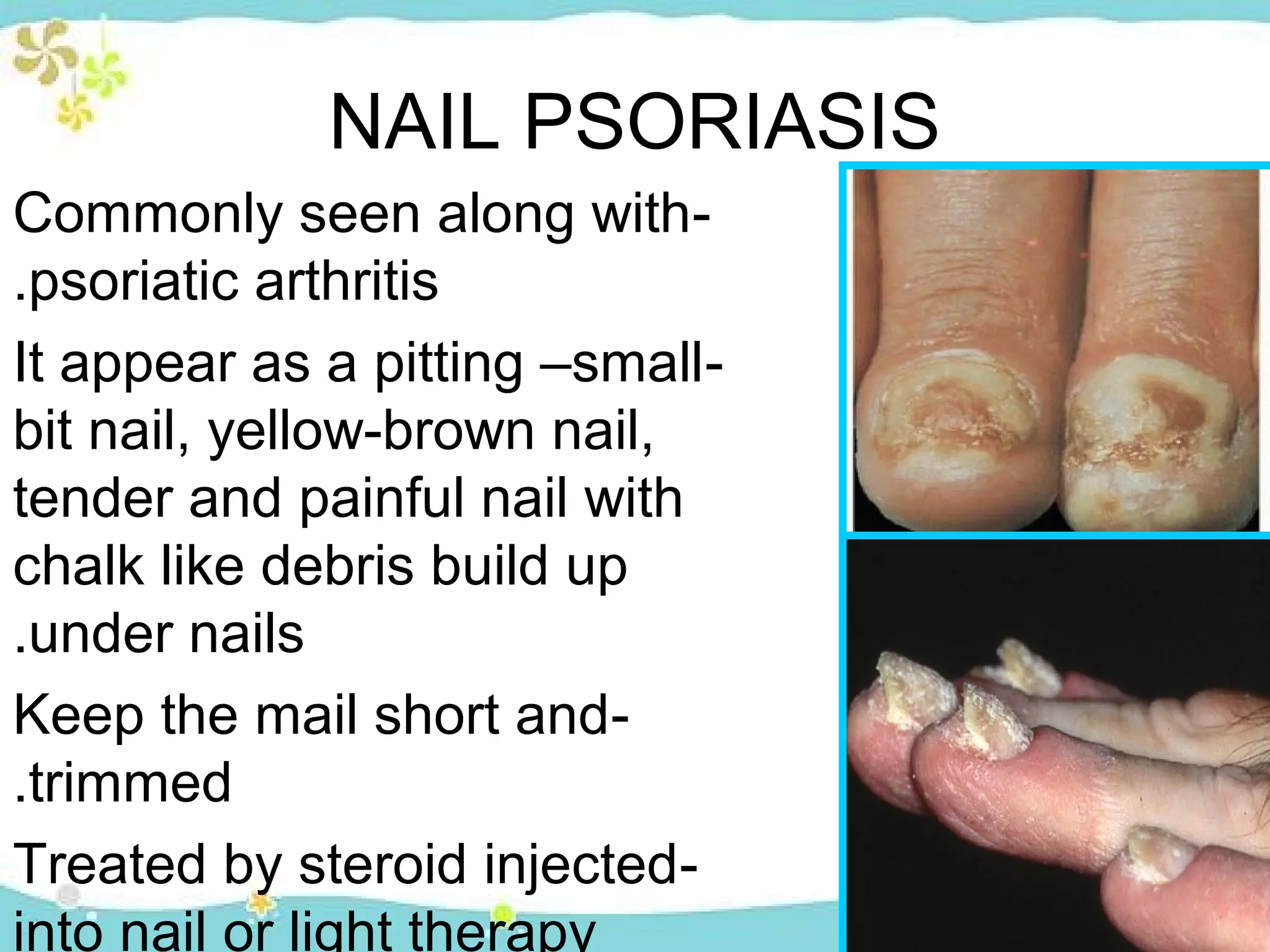 Psoriasis | PPT