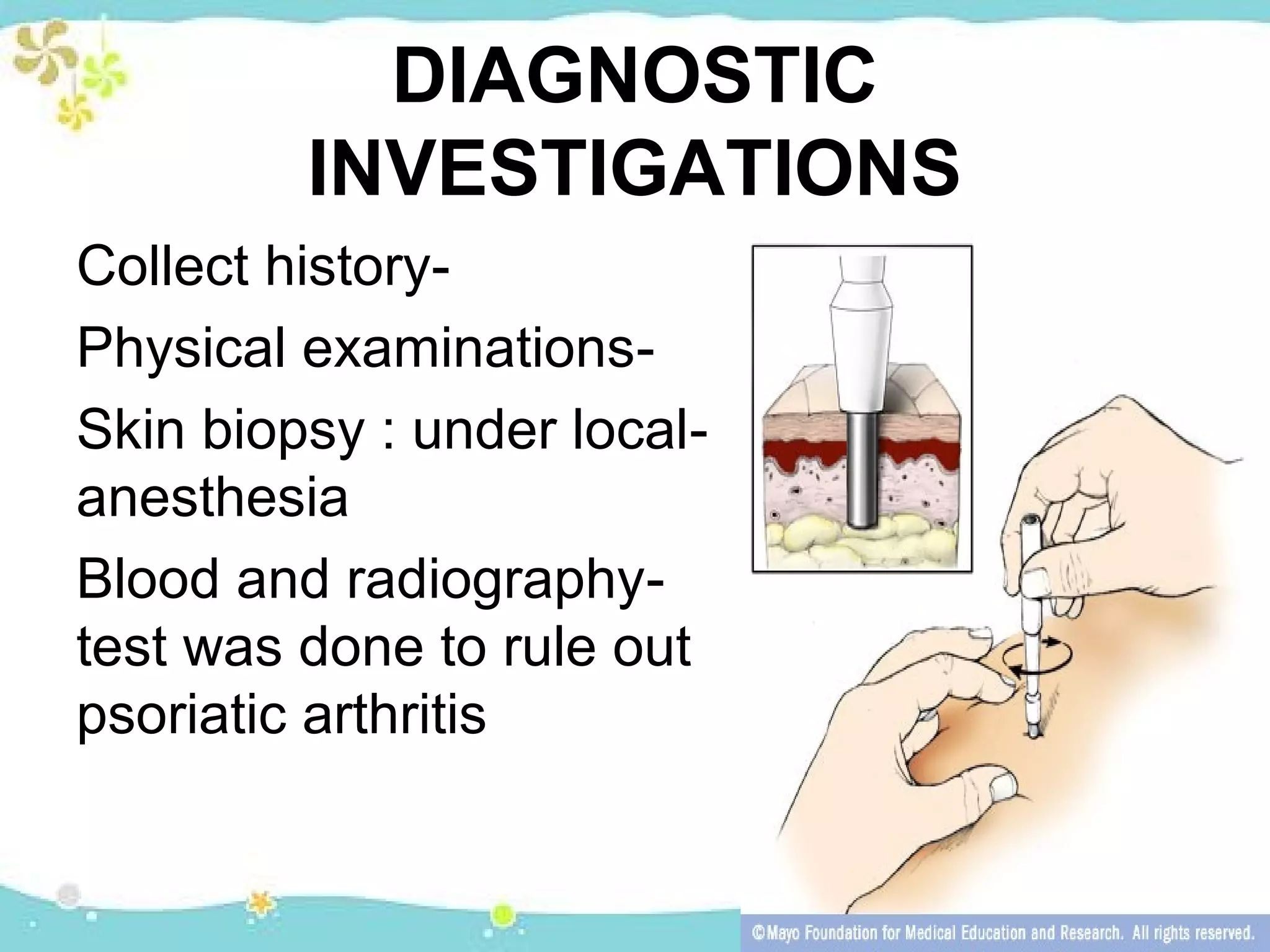Psoriasis | PPT