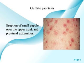 Papular Psoriasis