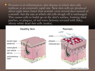 Psoriasis | PPT | Skin and Dermatology | Diseases and Conditions