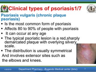 Psoriasis | PPT