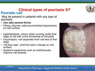 Psoriasis | PPTX
