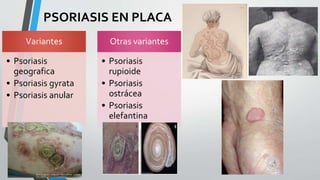 Psoriasis | PPTX