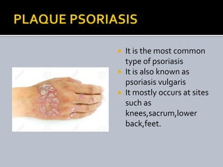 Psoriasis | PPTX