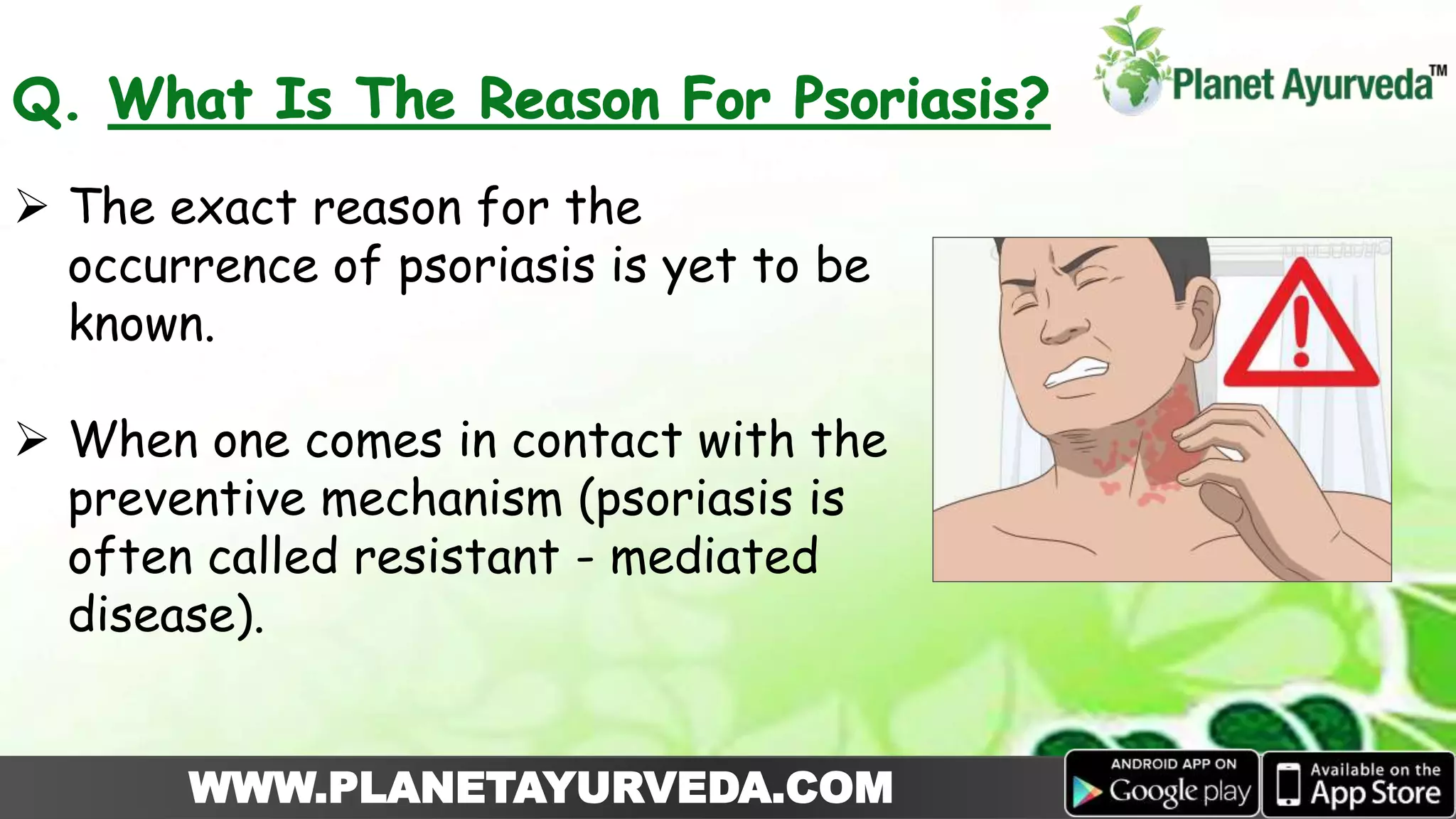 PSORIASIS - Frequently Asked Questions & Answers | PPTX