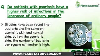 PSORIASIS - Frequently Asked Questions & Answers | PPTX