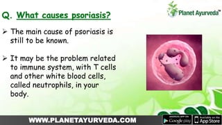 PSORIASIS - Frequently Asked Questions & Answers | PPTX