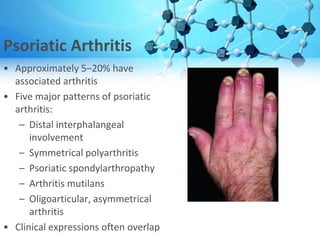 Psoriasis: Diagnosis and Management | PPTX
