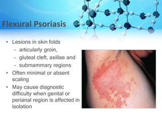 Psoriasis: Diagnosis and Management | PPT