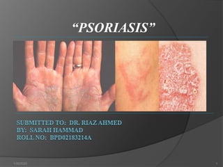 Psoriasis | PPTX