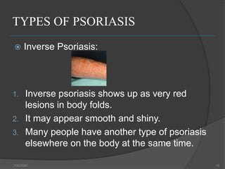Psoriasis | PPTX