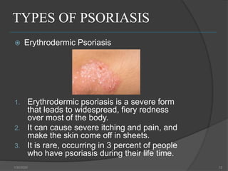 Psoriasis | PPTX