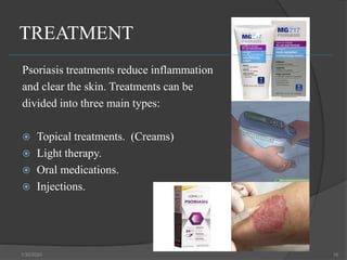 Psoriasis | PPTX