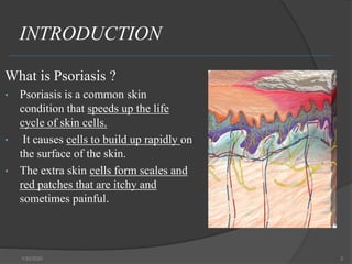 Psoriasis | PPTX