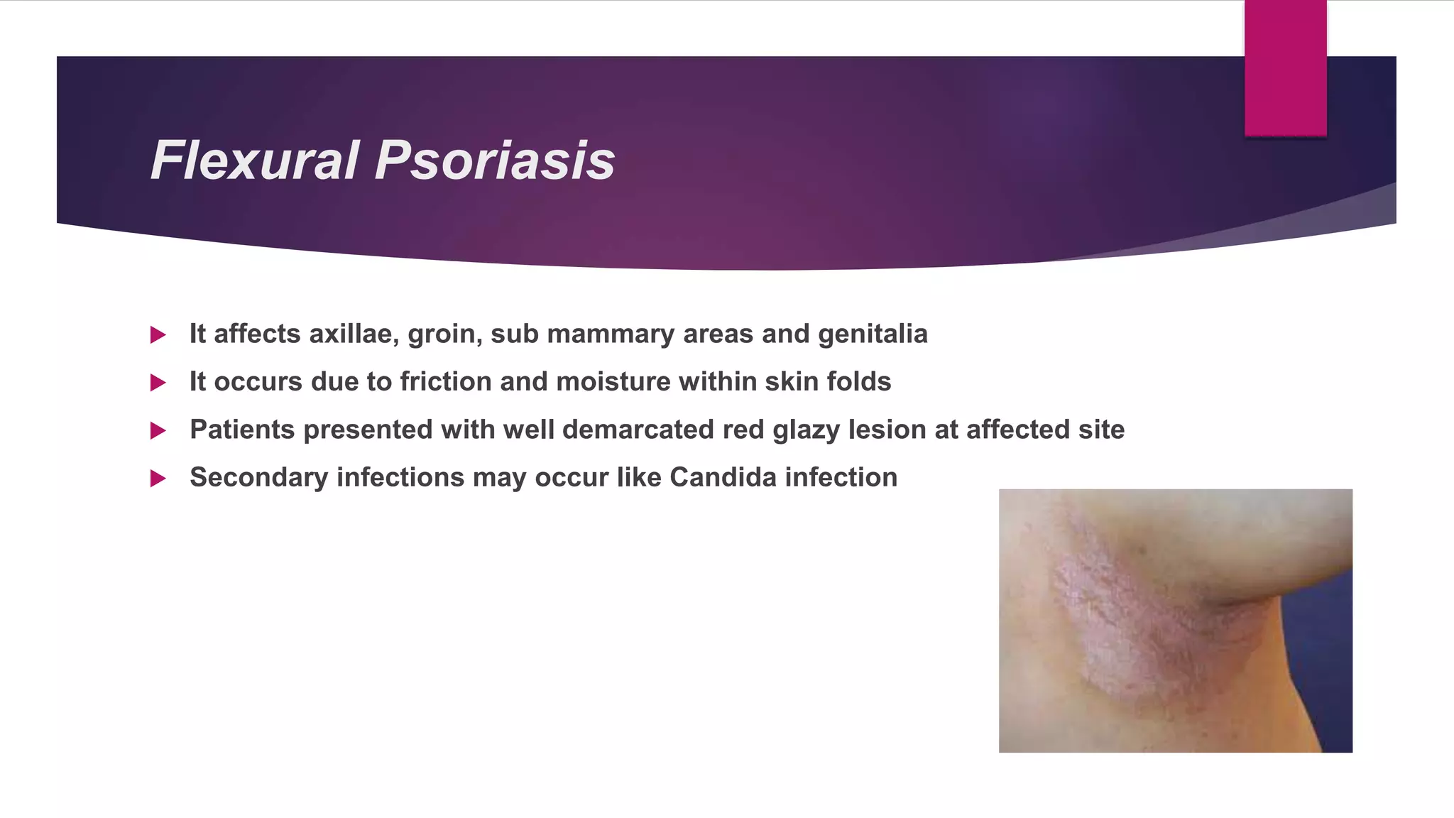 Psoriasis | PPTX