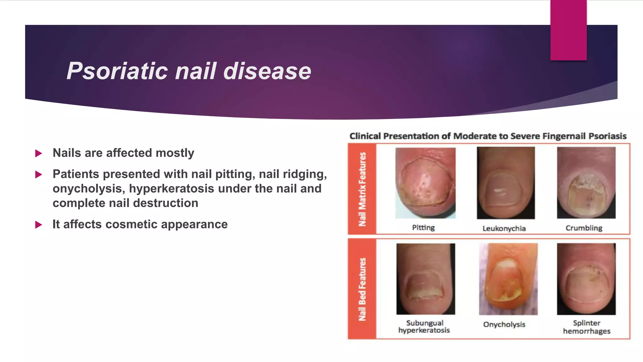 Psoriasis | PPTX