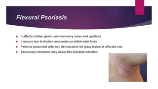 Psoriasis | PPTX