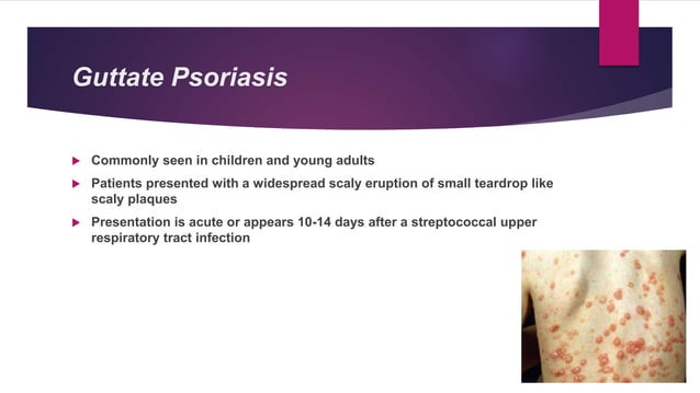 Psoriasis | PPTX | Skin and Dermatology | Diseases and Conditions