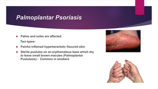 Psoriasis | PPTX