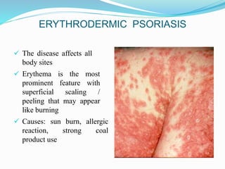 Psoriasis | PPTX